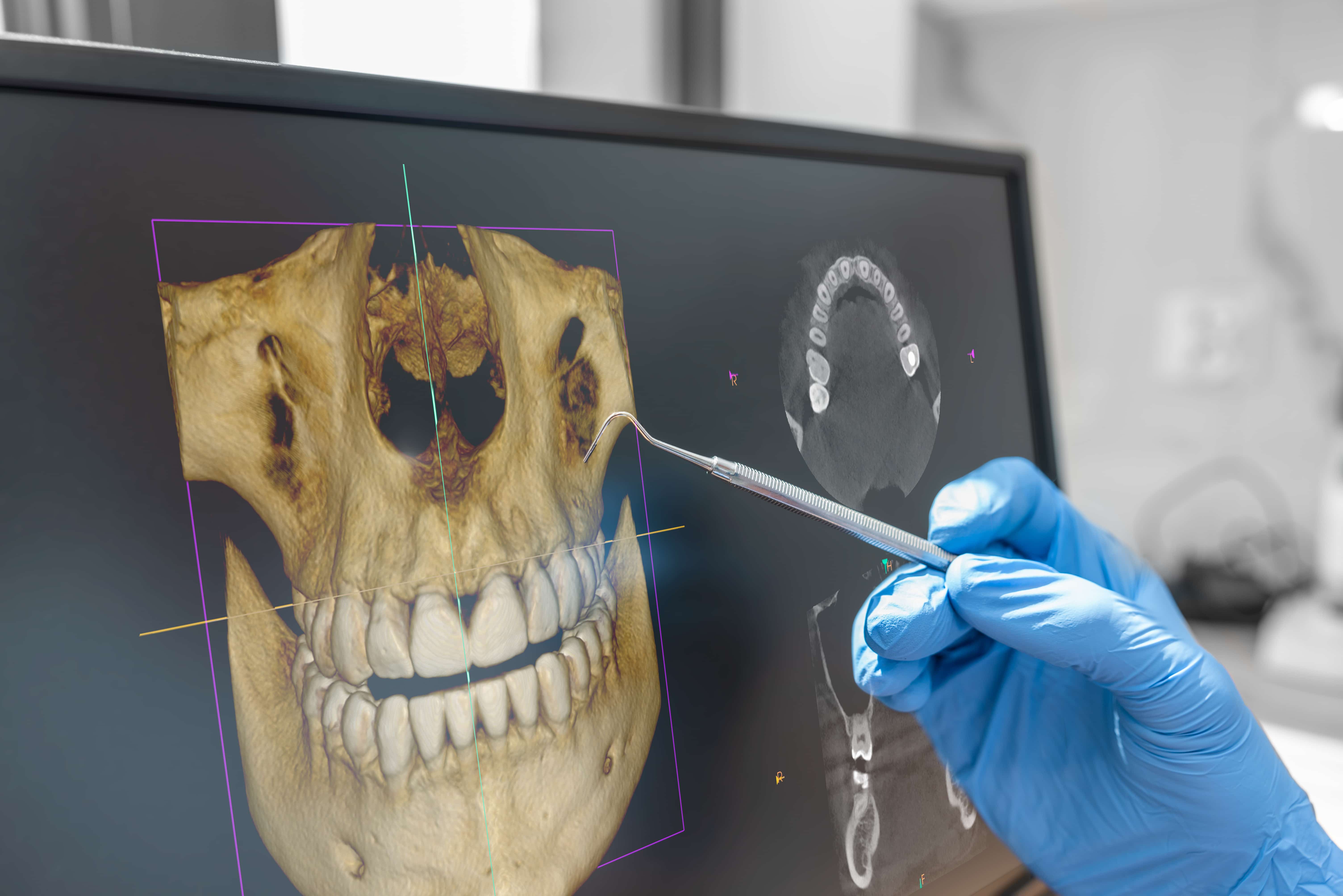 3D Dental Imaging | CBCT | Orthodontists Associates of WNY