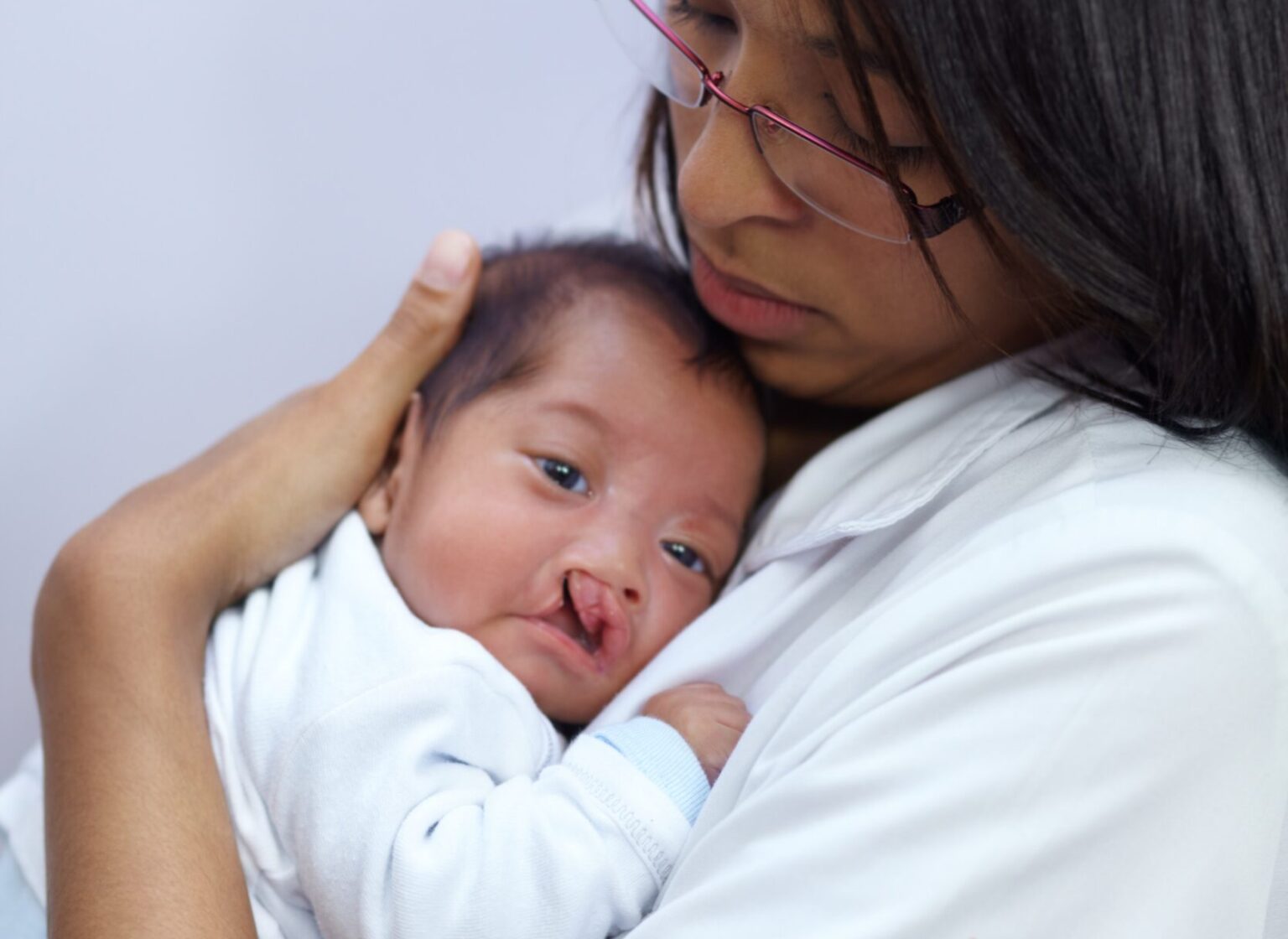 Craniofacial Orthodontic Treatment in WNY | Free Cleft Lip Consult